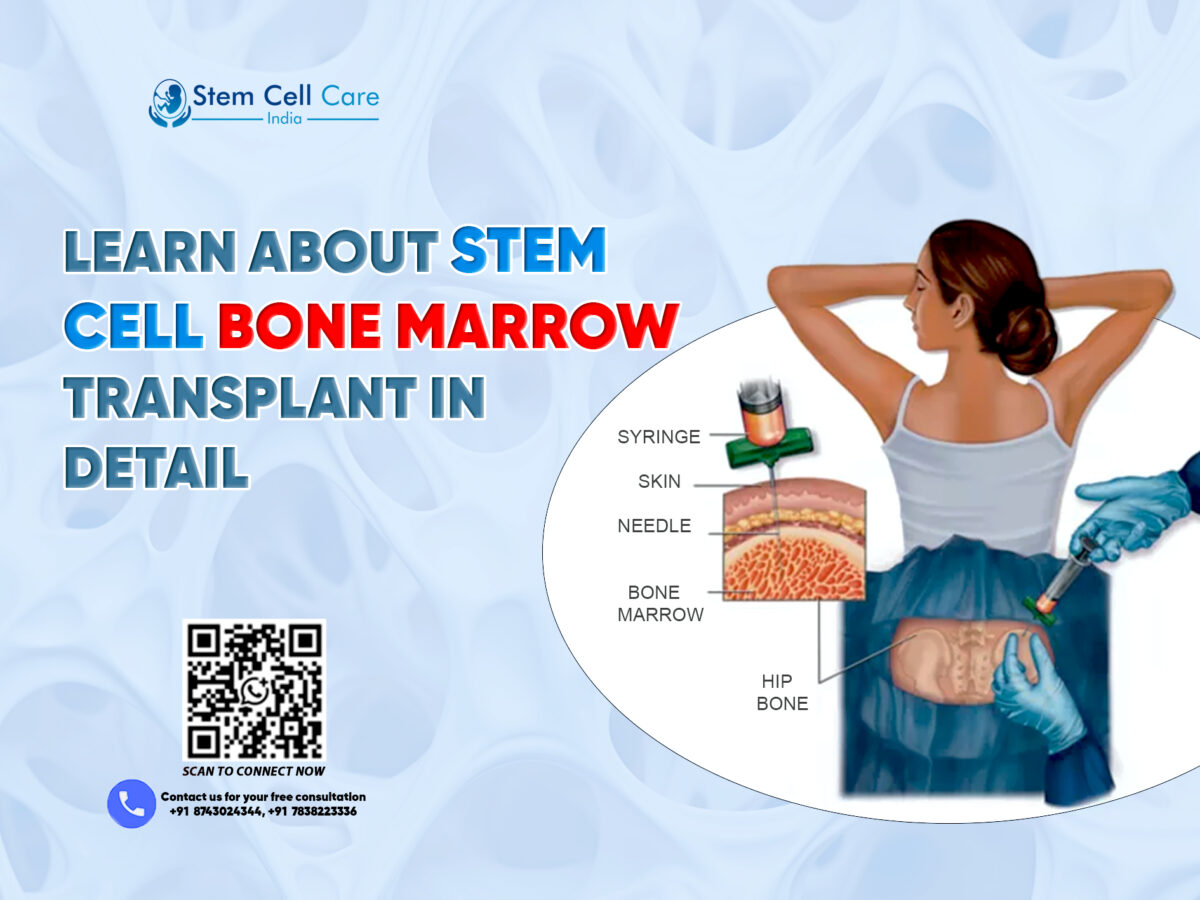 Learn About Stem Cell Bone Marrow Transplant in Detail Home