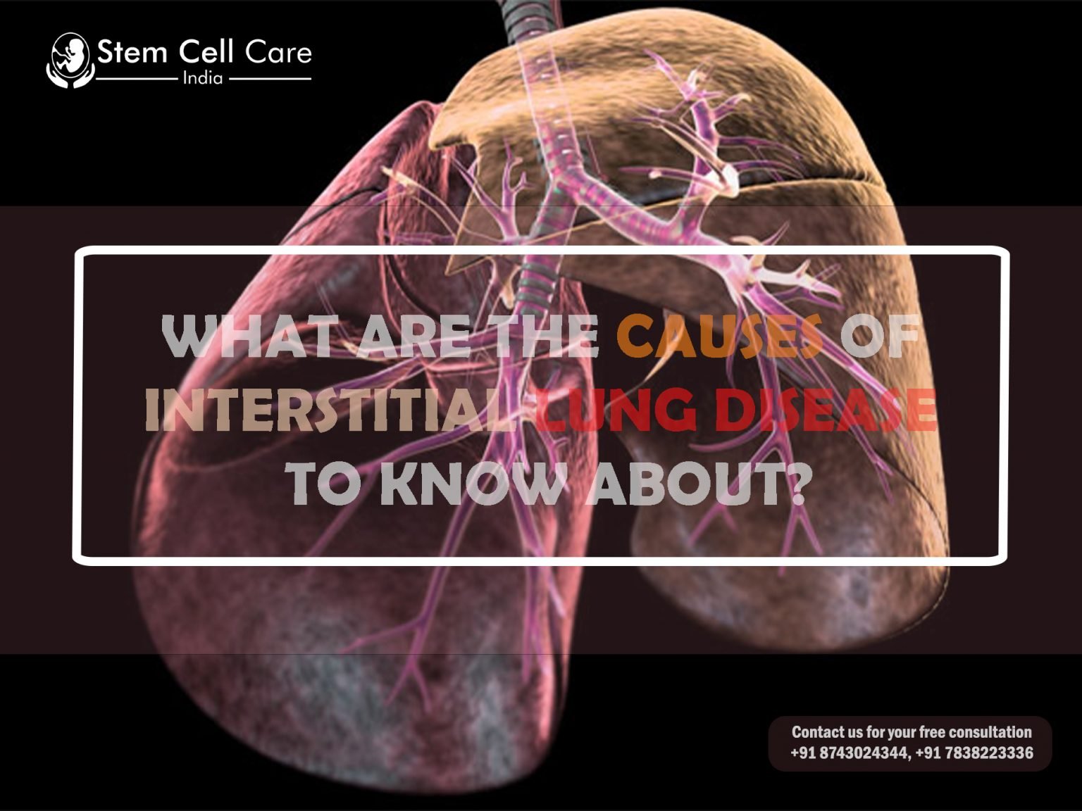 What are the causes of interstitial lung disease to know about? Home