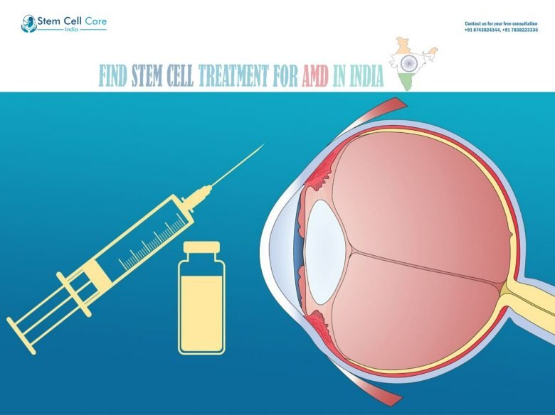 Find Stem Cell Treatment for AMD in India
