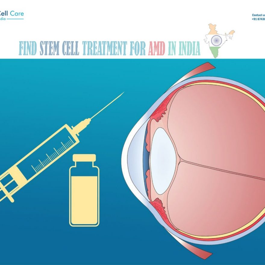 How Much Does It Cost To Do Stem Cell Therapy In India What Are The ...