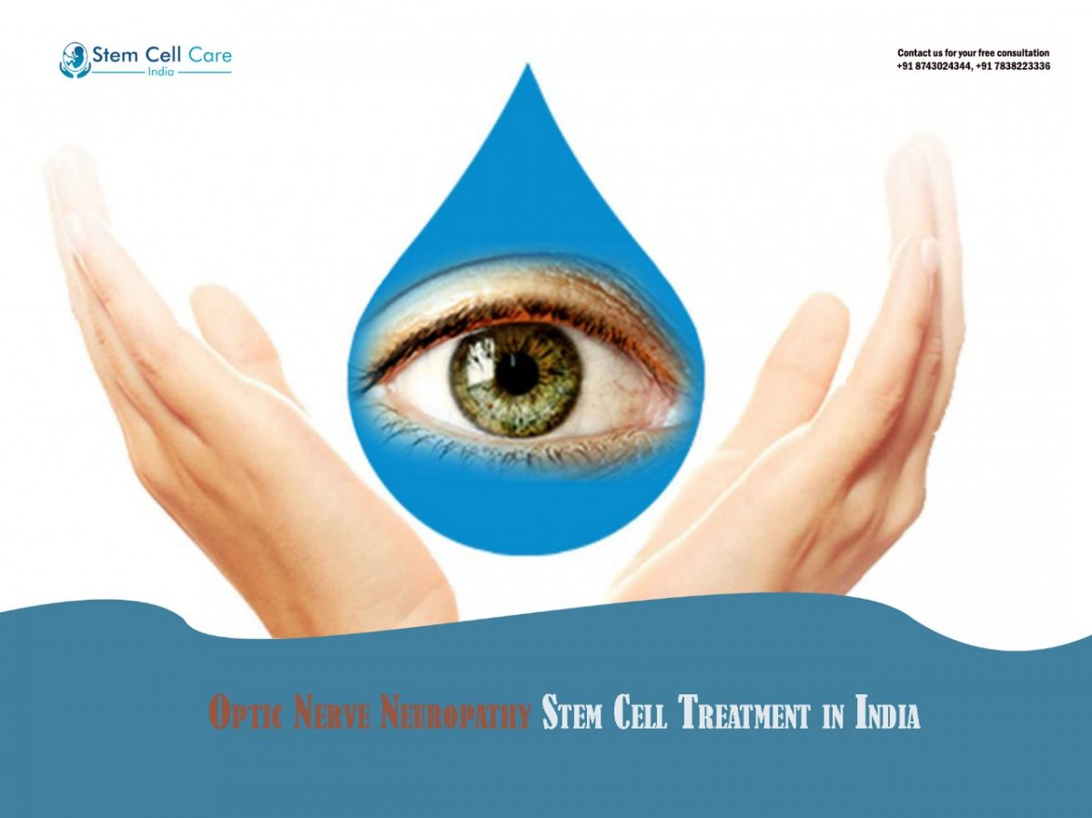 Optic Nerve Neuropathy Stem Cell Treatment in India