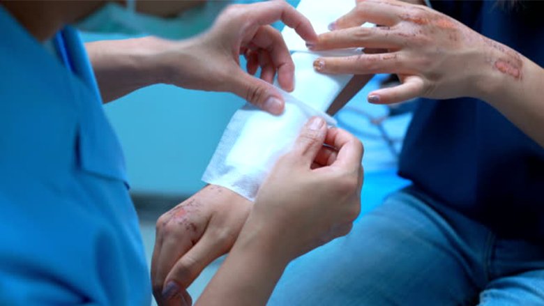 Diet Tips Plan for Major Skin Abrasions Patients - Stem Cell Care India ...