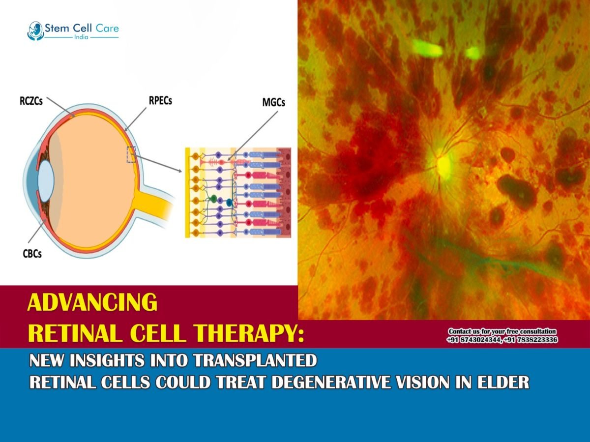 Advancing retinal cell therapy: New insights into transplanted retinal ...